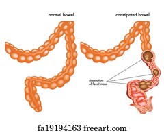 Free Intestinal Bacterial Flora Art Prints and Artworks | FreeArt