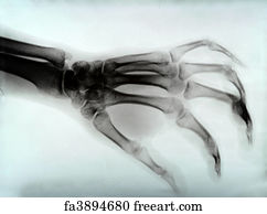 Free art print of Xray hand. Xray of a healthy right hand | FreeArt ...